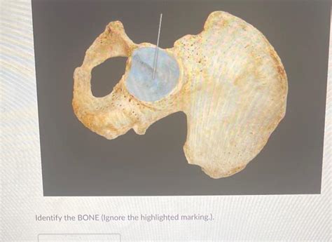 solved identify the bone ignore the highlighted marking