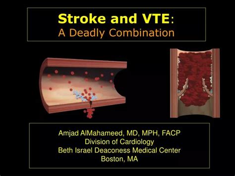 Ppt Stroke And Vte A Deadly Combination Powerpoint Presentation