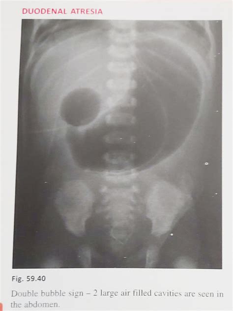 Pediatrics X Rays Pdf