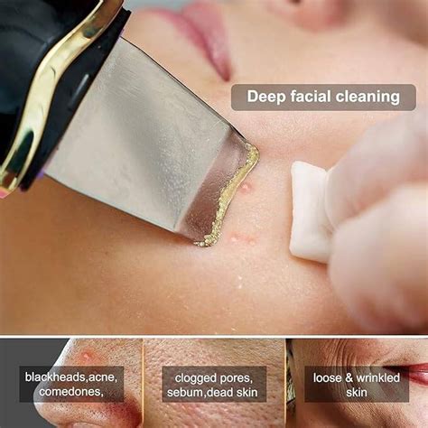 Professional Ultrasonic Facial Skin Scrubber Ion Deep Face Cleaning