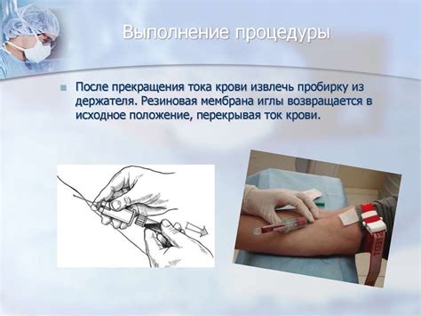 Взятие крови из периферической вены с использованием вакуумных систем ...