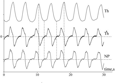 Figure 2 From Relevance Between The Oro Nasal Thermistor Signals Derivative And The Nasal
