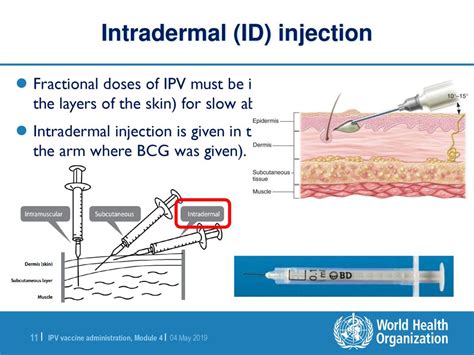 Including The Use Of Needle Free Injectors Ppt Download