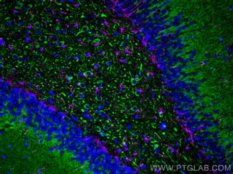Flexable Hrp Antibody Labeling Kit For Rabbit Igg Kfa005 Proteintech