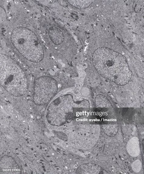 Immune Electron Microscopy Photos And Premium High Res Pictures Getty Images