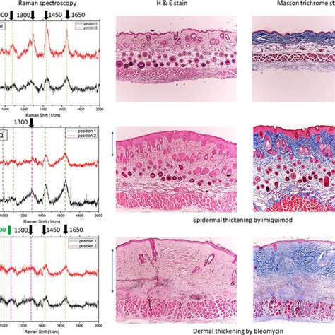 Distinguished Spectral Signals Of Surface Enhanced Raman Download
