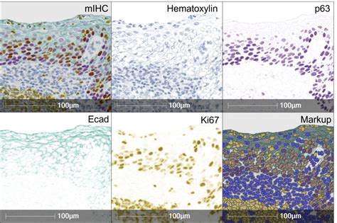 Indica Labs Multiplex Ihc Webinar
