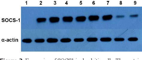 Figure 3 From Suppressor Of Cytokine Signaling 1 Socs1 Silencing And