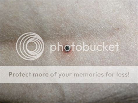 Hemangiosarcoma Health And Medical Discussion Greytalk