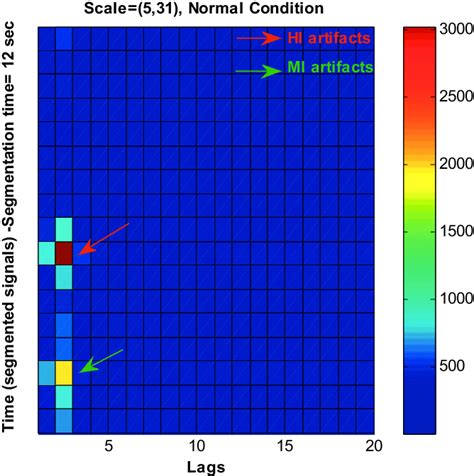 power spectral density of autocorrelated continuous wavelet coefficient
