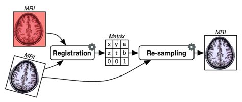 1 a typical neuroimaging workflow mixing several nature of data and