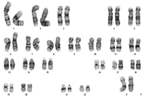 Ipsc重编程 赛尔普生物 Ipsc重编程 赛尔普生物
