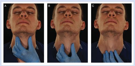 [pdf] Difficult Airway Society 2015 Guidelines For Management Of Unanticipated Difficult