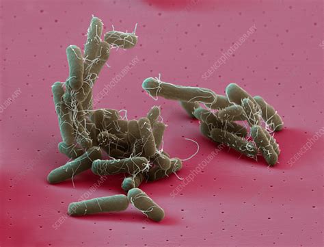 Salmonella Typhimurium Electron Micrograph