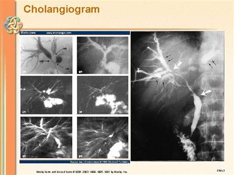 Chapter 6 Care Of The Patient With A