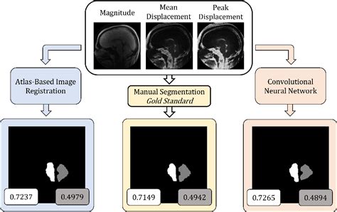 figure 1 from comparison of atlas based and neural network based