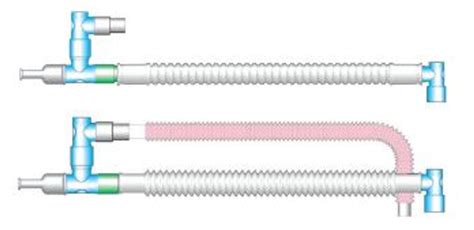 What Are The Different Vent Circuit Types Venture Respiratory Inc What Are The Different Vent Circuit Types Venture Respiratory Inc