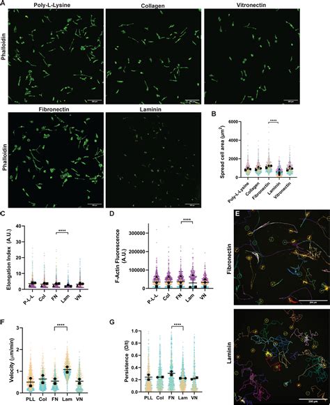 Macrophage Migration Is Differentially Regulated By Fibronectin And