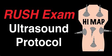 Echo Pocus 101