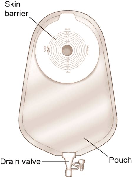 Types Of Ostomy Pouching Systems One Piece Two Piece And Accessories Uoaa