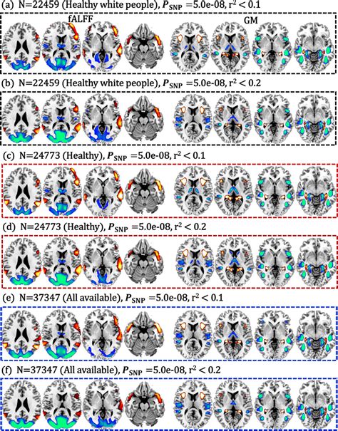 Replication Of The Identified Prs Associated Pattern Within Ukb Fusion Download Scientific