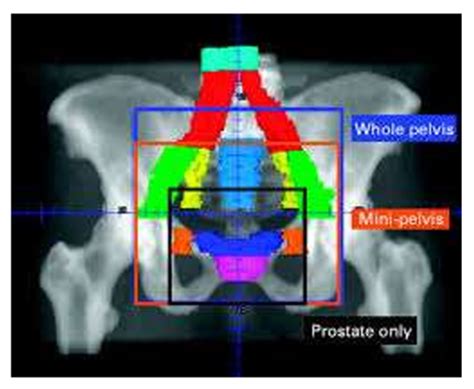 Pelvis Objectives Flashcards Quizlet