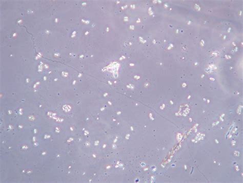 Nosema Ceranae The Inside Story Bee Health