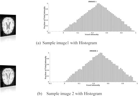 Sample Adaptive Histogram Equalization Ahe Results A Sample Image