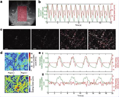 Combining Motion Tracking Analysis With A Genetically Encoded Calcium Download Scientific