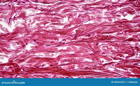 Microscopic Slide 400x Of Human Skin Section Showing Thick Cornified Layer On Bright Field Stock