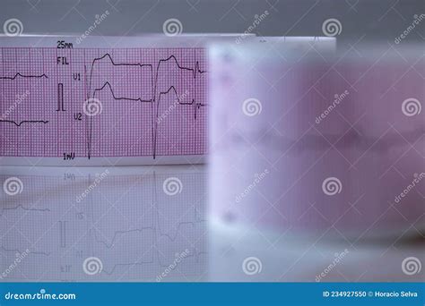 Close Up Of A Graph Paper Strip With Black Heart Waves Forming An