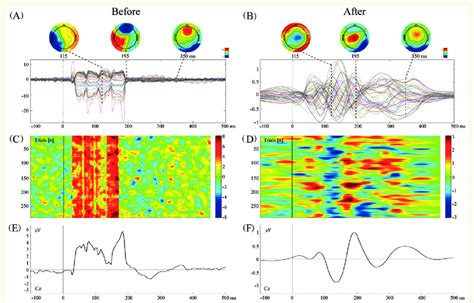 butterfly plot of auditory evoked potentials and single trial images