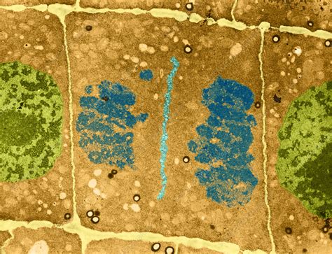Mitosis In Plant Cell Tem Stock Image C0282434 Science Photo