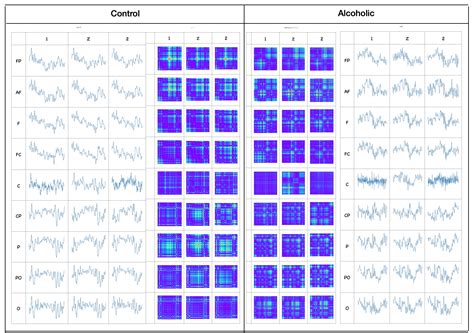 Eeg Patterns By Deep Learning And Graph Mining Sparkling Data Ocean