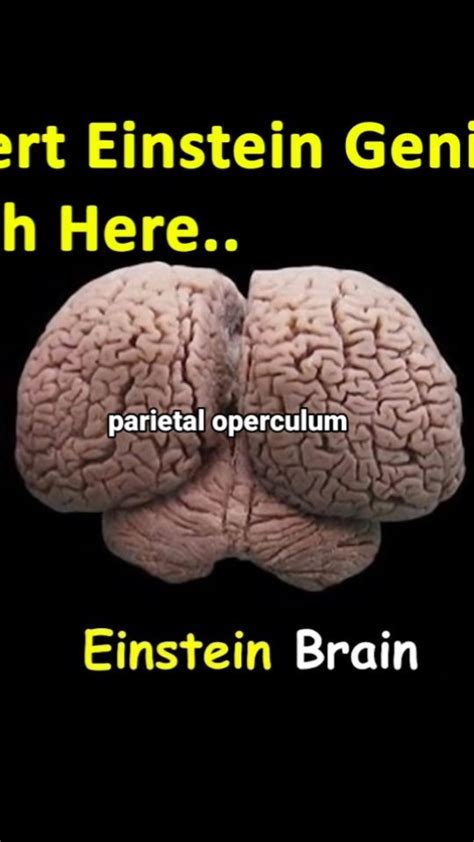 Albert Einstein Brain Vs Normal Brain