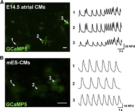 Optimization Of Direct Fibroblast Reprogramming To Cardiomyocytes Using Calcium Activity As A