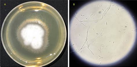 Pink Cottony Colonies With Irregular Margin On Sda A Fusiform