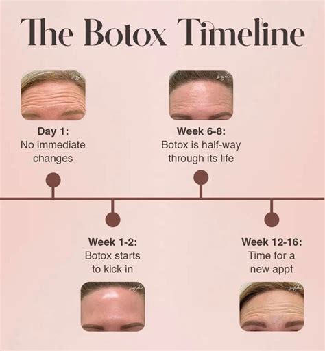 Botox Before And After Photos And Everything You Need To Know