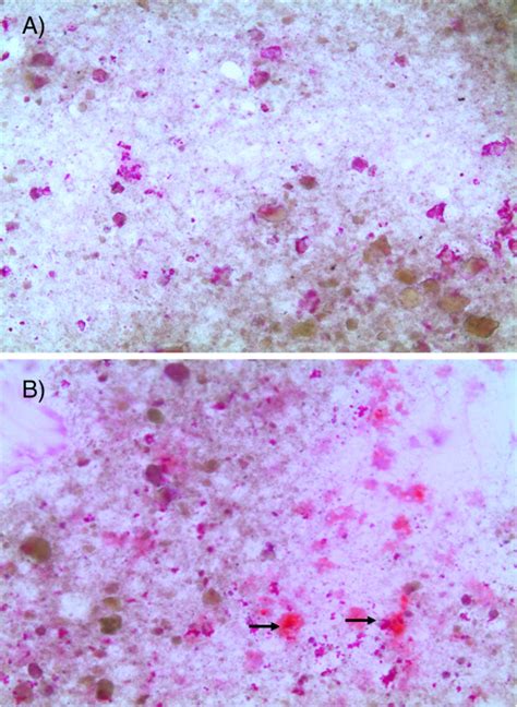 Cell Mineralization Stained With Alizarin Red One Week After Seeding