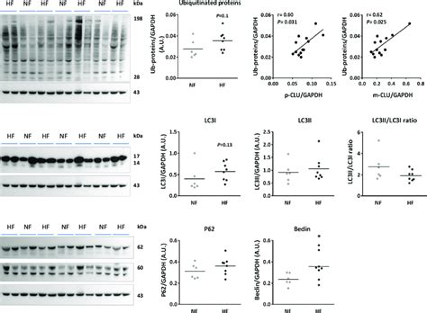 Increased Clusterin Expression In Human Cardiac Biopsies From Control