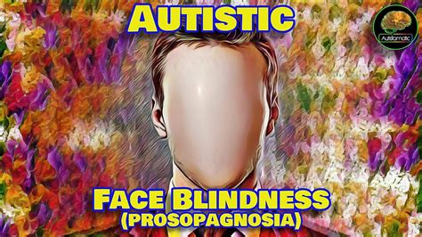 Autistic Face Blindness 1 Prosopagnosia Transcript