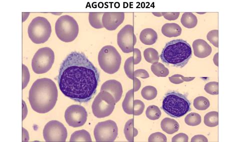 Lamina De Eritrocitos