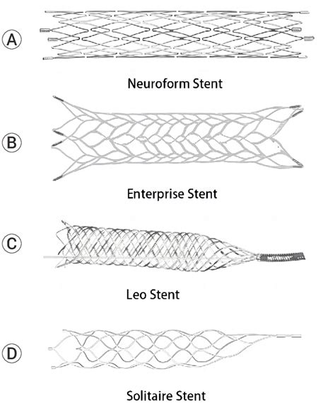 Figure 2 From Endovascular Treatment Of Intracranial Aneurysms Past