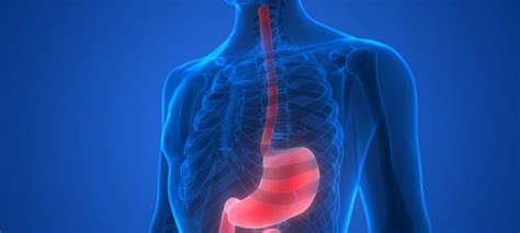 Esofagite O Malattia Da Reflusso Gastroesofageo Sanità Senza Problemi