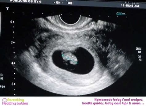 Week 8 Of Pregnancy Pregnancy Week By Week Pregnancy Week By Week