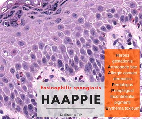 Gerônimo Júnior On Linkedin Pathology Pathologist Dermpath