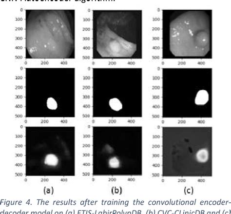 figure 4 from automatic colon polyp detection using convolutional
