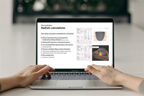 Webinar Automated Qa In Clinical Environment Radcalc Set Up For