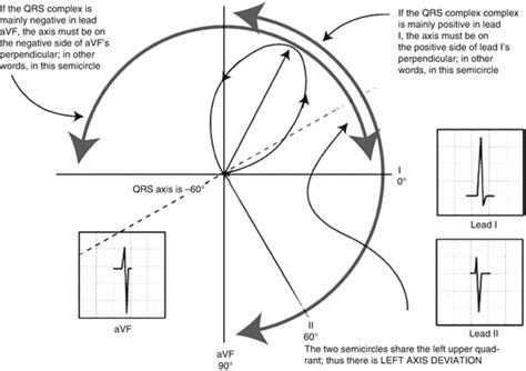 Qrs Complex Thoracic Key