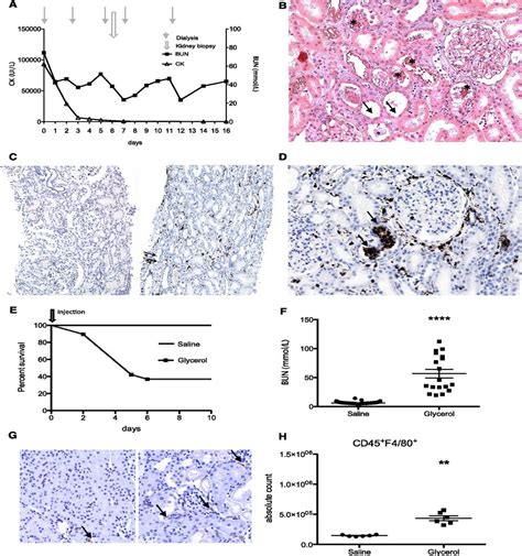 specific macrophage subtypes influence the progression of rh